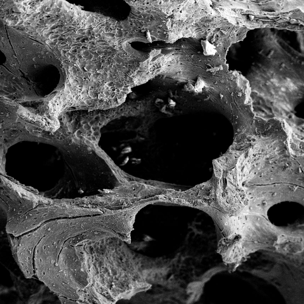 BVital GenOSS Syringe – MoreDent